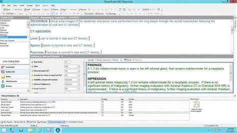 Dr Tarik Alkasab Demonstrates Powerscribe 360 Clinical Guidance Youtube