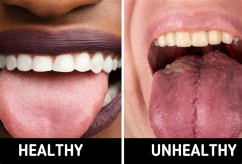 8 Body Warning Signs You Shouldnt Ignore Likya