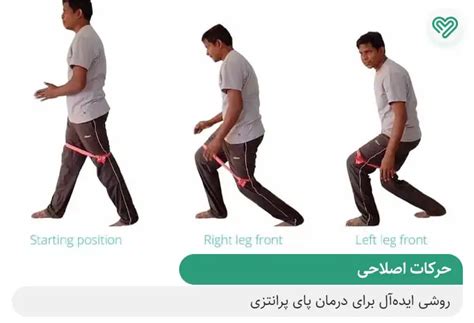 بهترین درمان زانوی پرانتزی علائم و تشخیص این بیماری آی آر مای شاپ