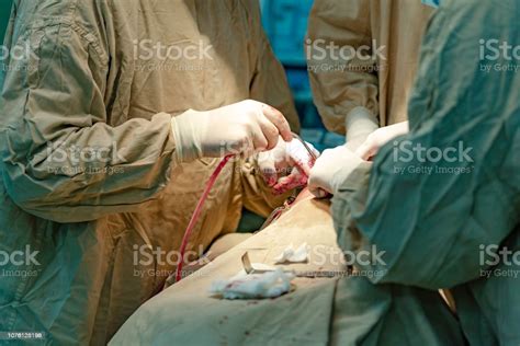 외과 의사의 팀 화이트 피 멸 균 장갑 병원 수술 실에서 수술을 하 고 있는 동안 얼룩에 손 가정의 방에 대한 스톡 사진 및 기타 이미지 Istock