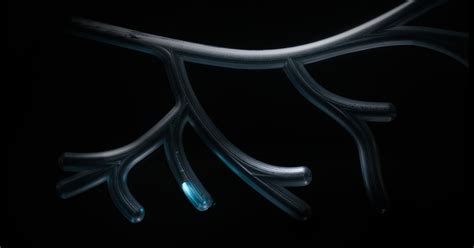 Intuitive Robotic Assisted Bronchoscopy Ion Platform