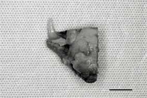 Macroscopic View Of The Tumor Bar 1cm Download Scientific Diagram