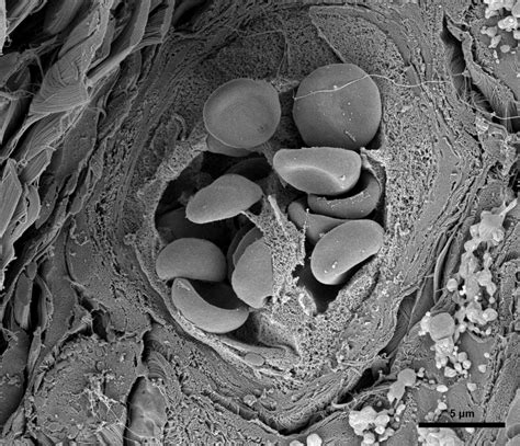 Transmission Electron Microscopy Red Blood Cell At Leo Bunker Blog