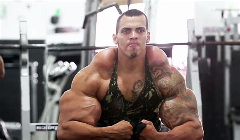 Synthol Side Effects