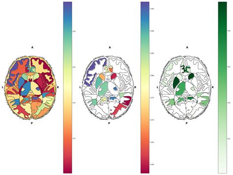 Visualisation Tools NIMAGEN Documentation