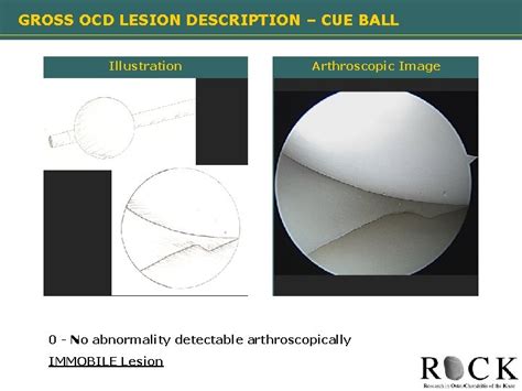 Rock Athroscopy Classification 1 Rock Classification Committee 2