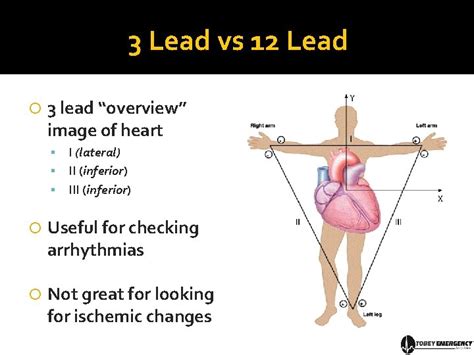 Almost Everything You Wanted To Know About Ecgs