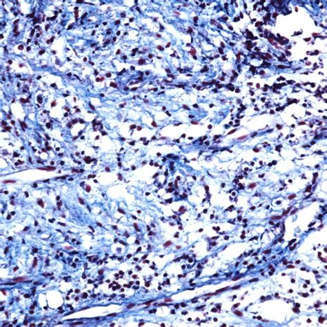 Diffuse Pulp Calcifications He Staining ×200 Download Scientific Diagram