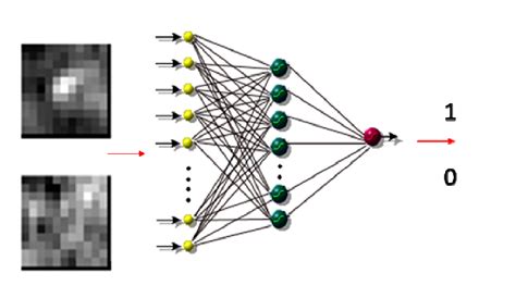 Ann For Classification Of Microcalcification Contained An Input Layer Download Scientific