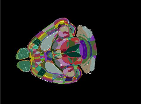 Atlas Segmentation With Trailmap Axon Segmentation Masks Image Analysis Image Sc Forum