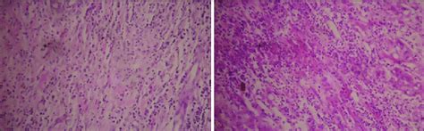 A Microwave Processing Versus Conventional Processing Of Tissues Download Scientific Diagram