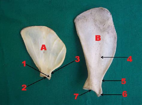 Photograph Showing The Tubercle 1 Glenoid Cavity 2 Neck 3 Of