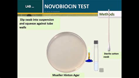 Novobiocin Test Coagulase Negative Staphylococci S Epidermidis And S