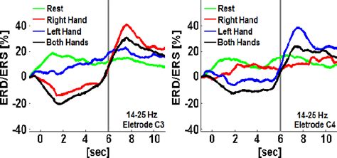 Figure 1 From Comparison Of Sensorimotor Rhythms In Eeg Signals During