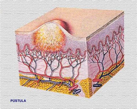 Atlas De Dermatologia