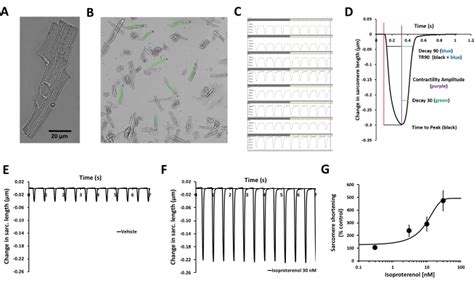 Measurement Of Heart Contractility In Isolated Adult Human Primary Cardiomyocytes