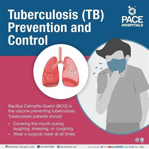 Tuberculosis Prevention And Control