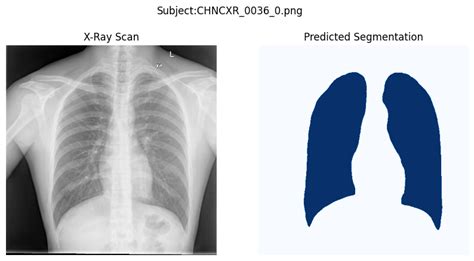 Implement 3d Unet For Cardiac Volumetric Mri Scans In Pytorch By Aimal Rehman Medium