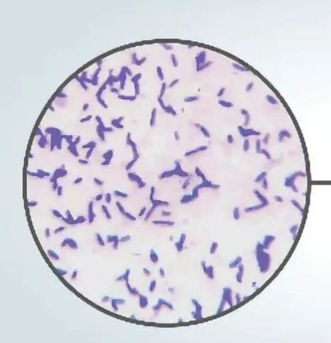 Lab Midterm Flashcards Quizlet Lab Midterm Flashcards Quizlet