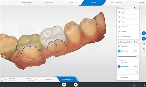 Software Cerec Dentsply Sirona Italia
