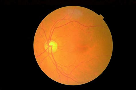 Bitter Gourd Augemented Dataset Roboflow Universe