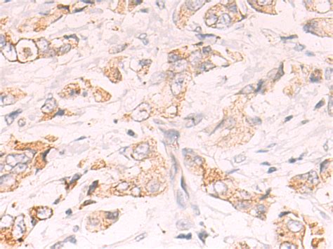 兔抗slc1a5多克隆抗体anti Slc1a5 Rabbit Polyclonal Antibody 生命科学产品与技术服务 生工生物工程