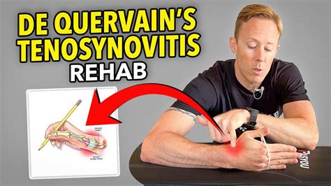 Rehab Exercises For De Quervains Tenosynovitis At Jamie Tolentino Blog