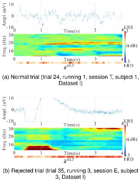 Figure 10 From Hierarchical Transformer For Motor Imagery Based Brain