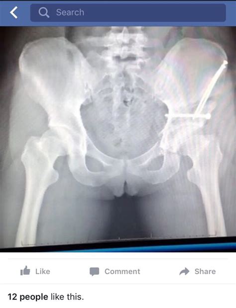 Discover More Like Nakedfacebook Hippa And Related Content Scrolller