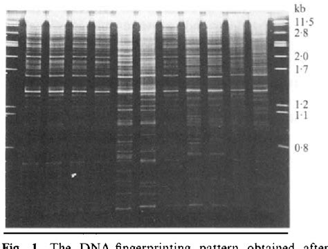 Figure 1 From Usefulness Of The Dna Fingerprinting Pattern And The Multilocus Enzyme