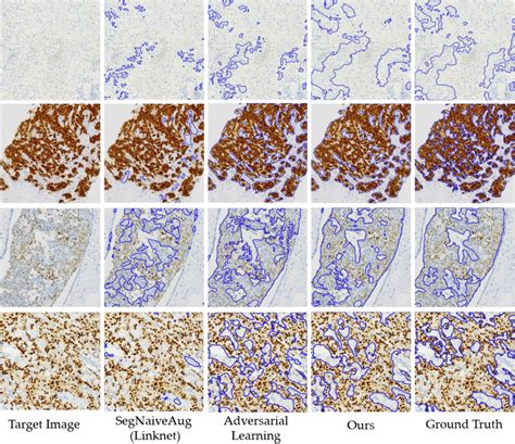 Example Results Of Adapted Segmentation For He Stained Images To Ihc Download Scientific