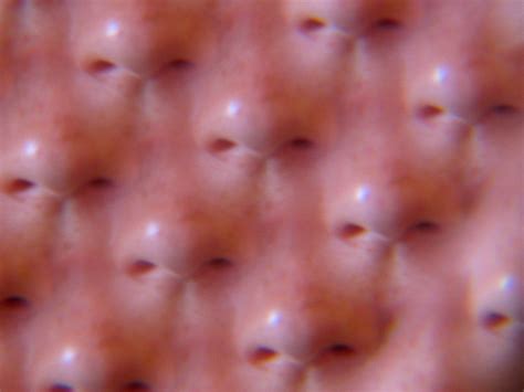 ¿qué Es La Alucinación Olfativa Síntomas Causas Y Tratamiento