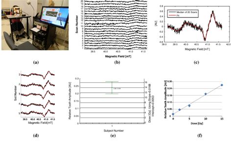 In Vivo Measurement Process For Epr Tooth Dosimetry Data Are For