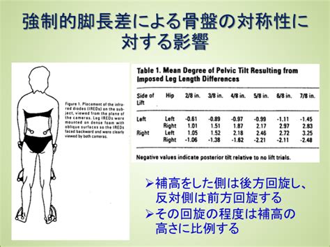 脚長差と痛みの関係 統合運動器Taijikuアカデミー