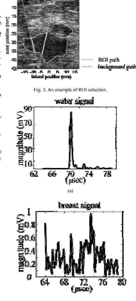 Figure 1 From Parametric Ultrasonic Imaging Using Linear Arrays For Breast Cancer Detection