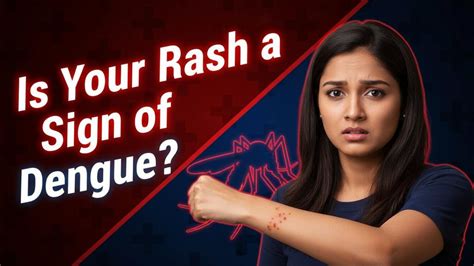 Dengue Fever Skin Rash Treatment Expert Advice From Kailash Hospital Dehradun