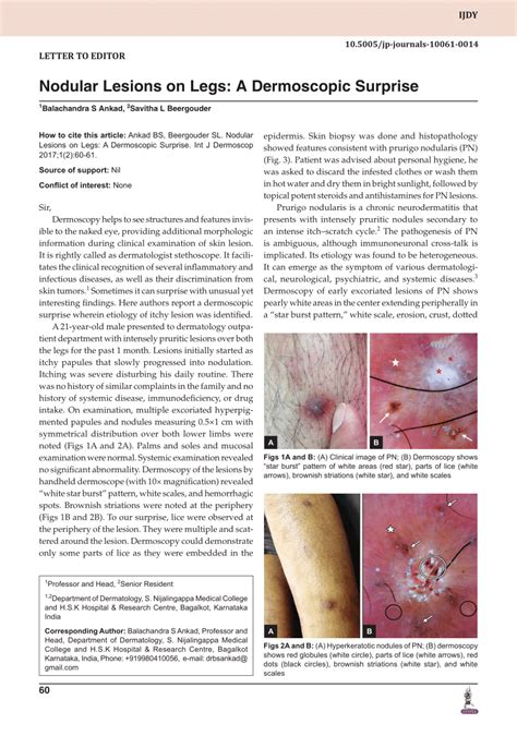 Pdf Nodular Lesions On Legs A Dermoscopic Surprise