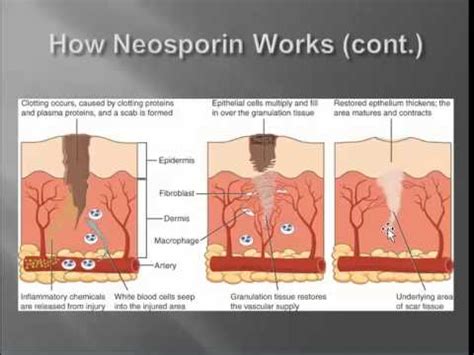 Group 23 Chemistry Of Neosporin Youtube