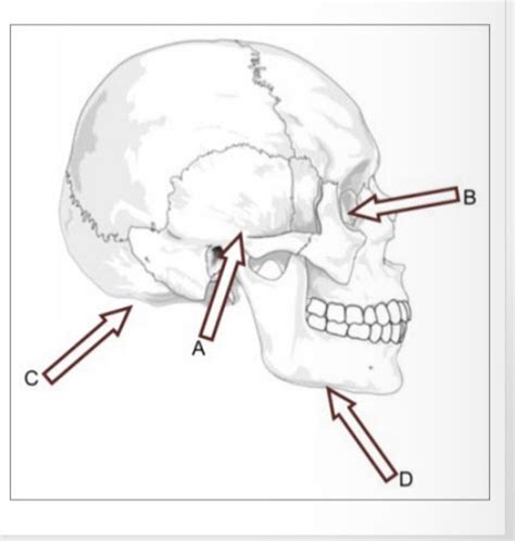 Transcranial Doppler Tcd Flashcards Quizlet