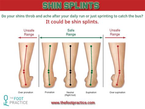 Corns And Calluses Treatment Singapore Site Title