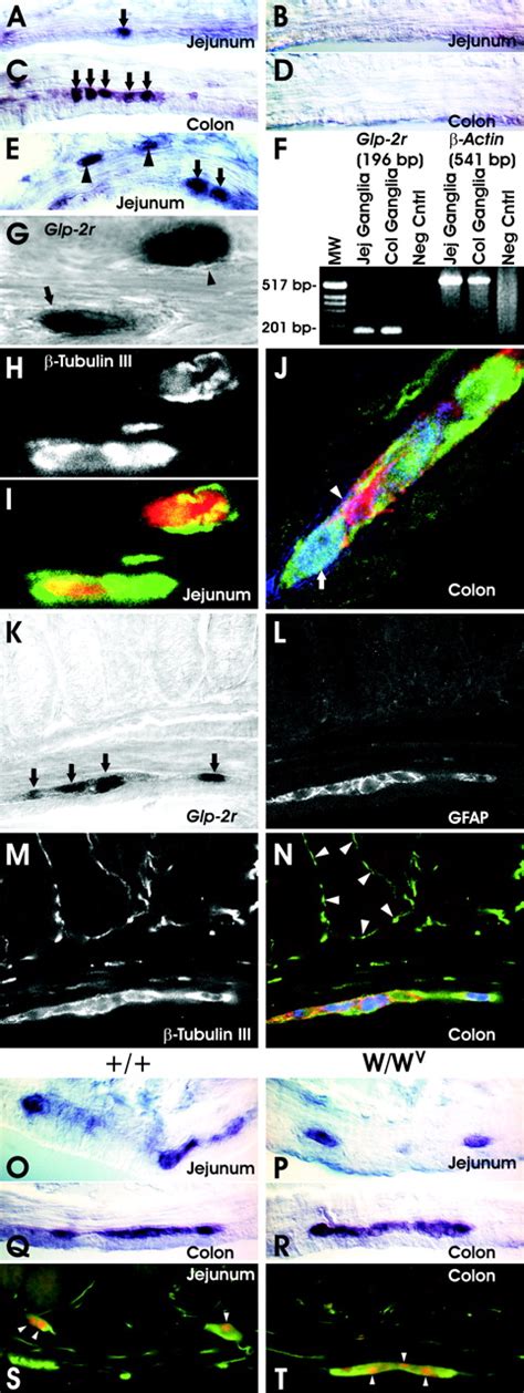 Modulation Of Specific Intestinal Epithelial Progenitors By Enteric