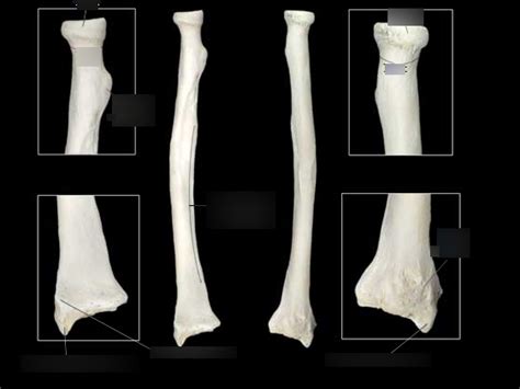 Radius Diagram Quizlet