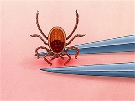 Лаймска Болест симптоми и кърлежите Kontiki Bg
