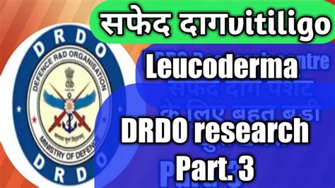 सफेद दाग Leucoderma Best Treatment Tips Part 3 Youtube