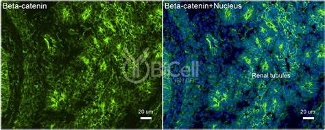 Beta Catenin Ctnnb1 Antibody Bicell Scientific®