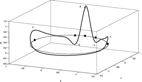 Figure 1 From Model Based Ecg Fiducial Points Extraction Using A Modified Extended Kalman Filter