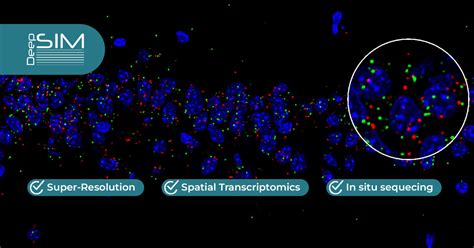 Super Resolution Microscopy Increases Amplicon Spots Detection
