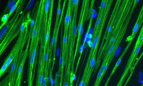 Bit Bio Launches Custom Disease Model Cells Drug Discovery World Ddw