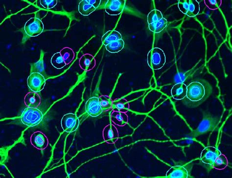 Segmenting Neurons And Other Cells Image Analysis Image Sc Forum