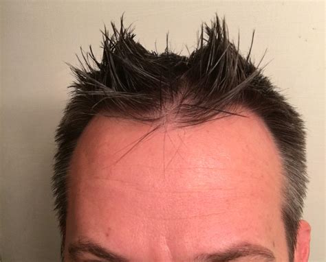 The Problem With Vr Headsets That No One Talks About R Oculus